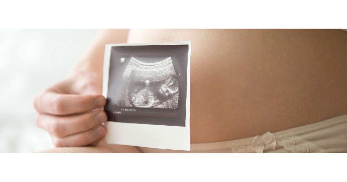 Anomaly Ultrasound Scan | 20 Week Scan Solihull Ultrasound
