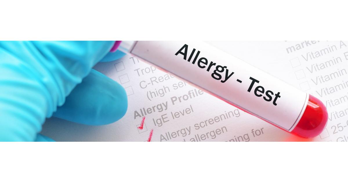 Alex 2 Allergy Test