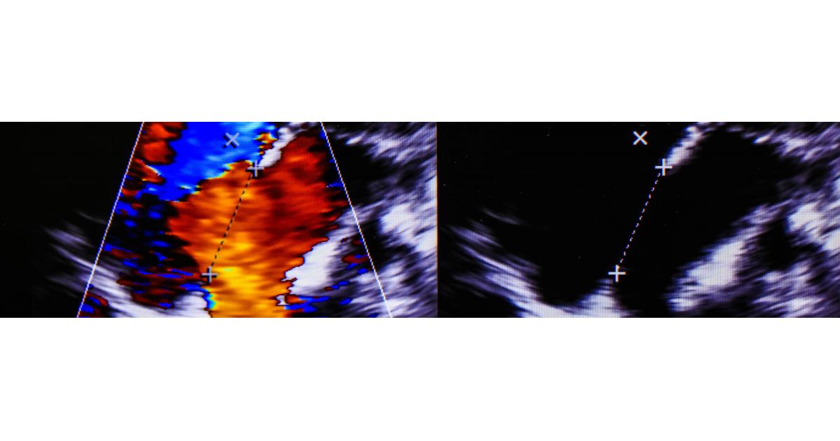 Private Echocardiogram | Ultrasound Of The Heart | MUMS